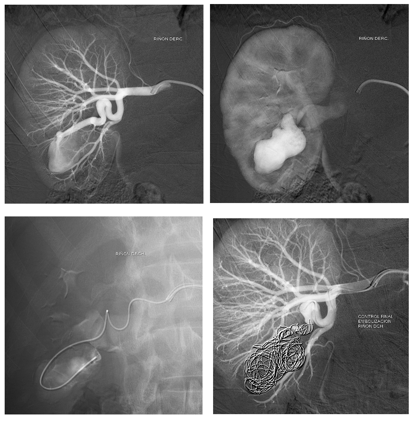Unidad de Patología Vascular | La Unidad de Patología Vascular está formada por los cirujanos ...