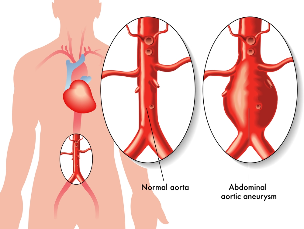 Unidad de Patología Vascular | La Unidad de Patología Vascular está formada por los cirujanos ...